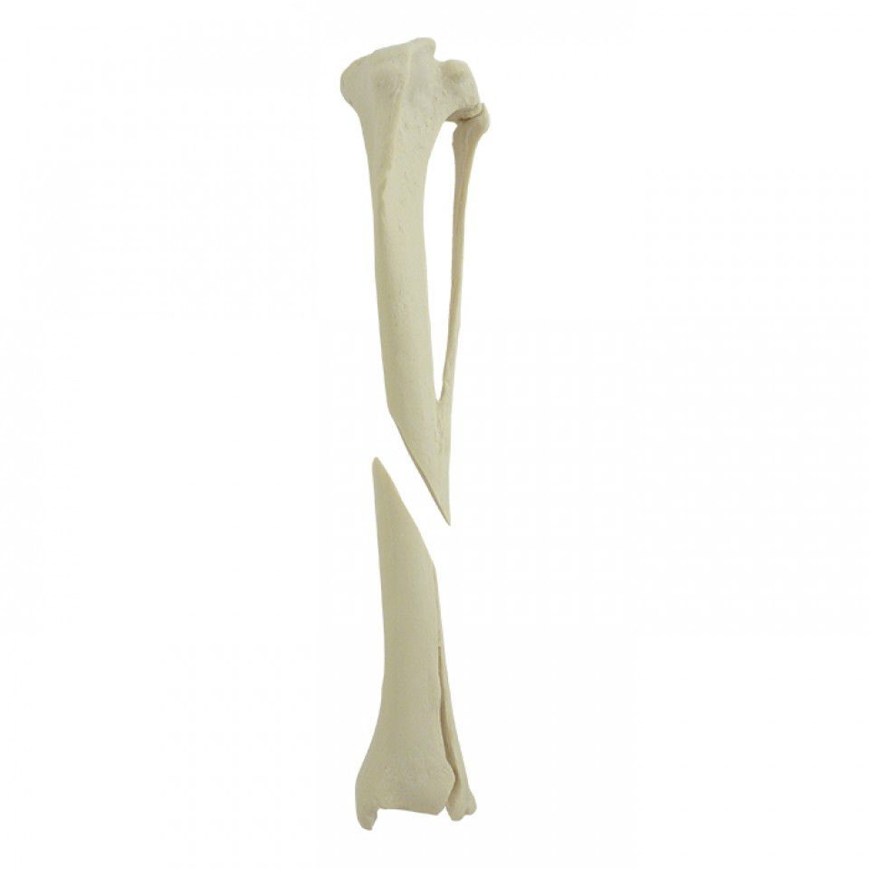 Tibia anatomical model - AV260ESPF2 - Nacional Ossos - surgical ...