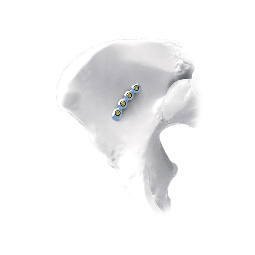 Pelvis compression plate - Curved - NORMMED Medical Devices - locking ...