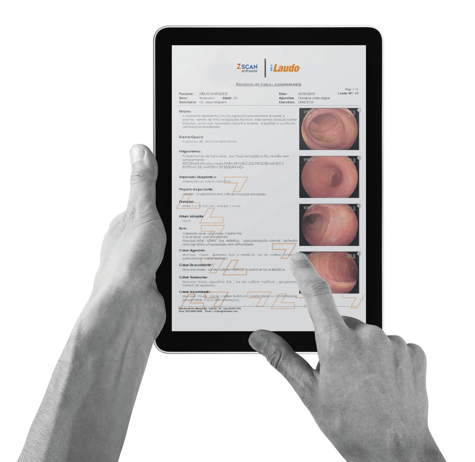 Image analysis software - Zscan Plus - Zscan software - data management ...