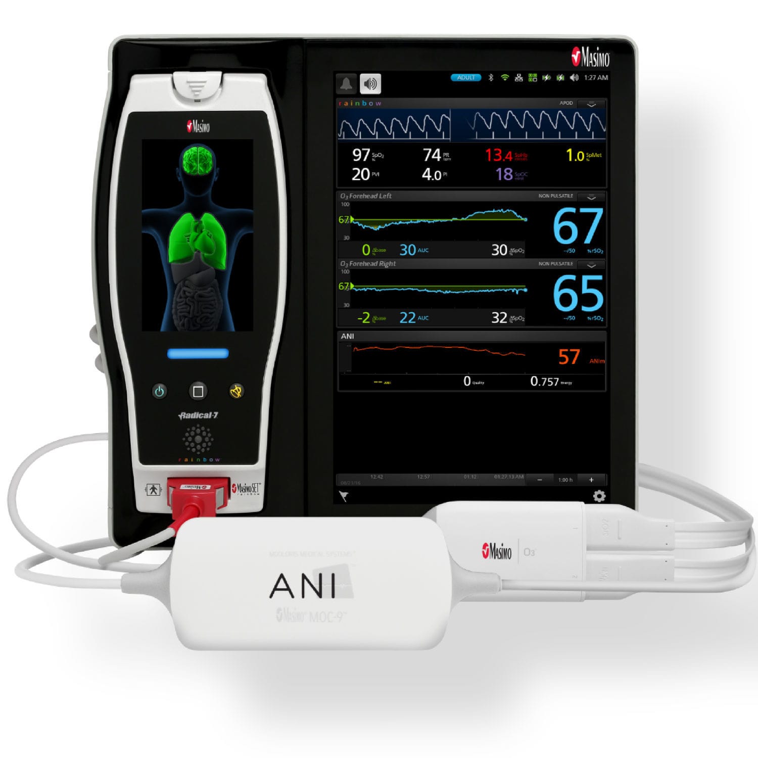ANI module for patient monitor - ANI MOC-9 V1 - Mdoloris Medical ...