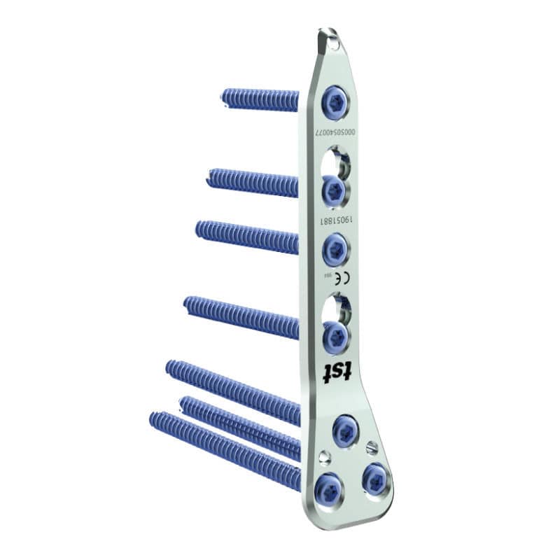 Tibia osteotomy plate - 31610000200 - Peditst - medial / distal / locking