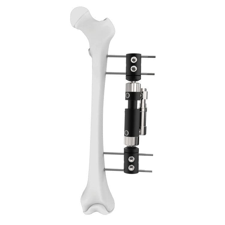 Femur external fixation system - DAF - Peditst - tubular / pediatric