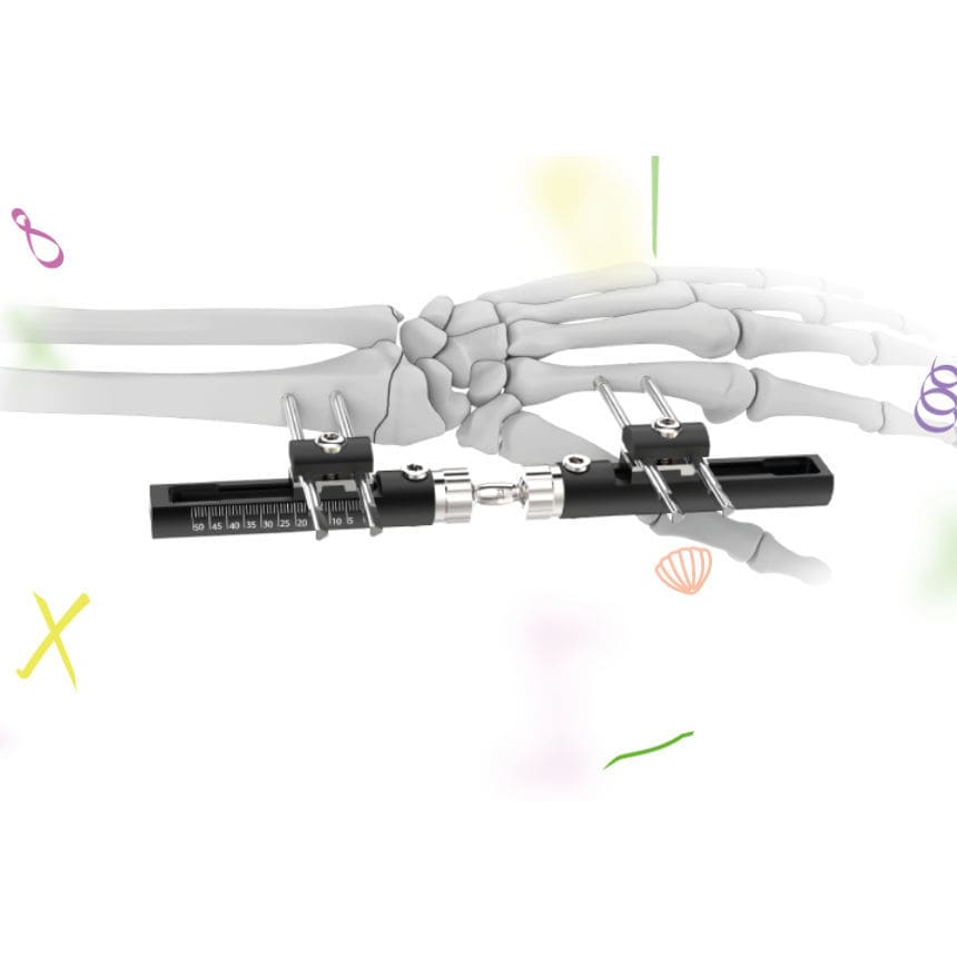 Wrist external fixation system - WristX - Peditst - tubular / pediatric
