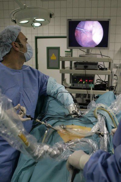 ENT surgery laser - OPAL 10/25 - Lasram Laser - gynecological surgery ...