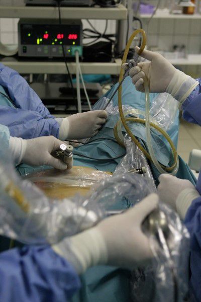 ENT surgery laser - OPAL 10/25 - Lasram Laser - gynecological surgery ...