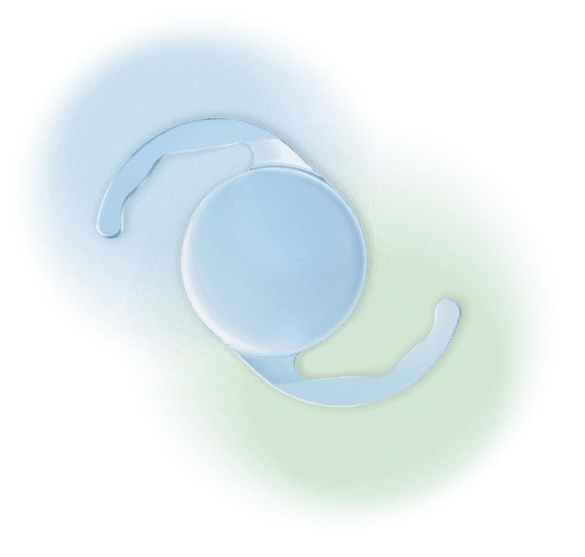 Monofocal intraocular lens - Evpl - Aurolab