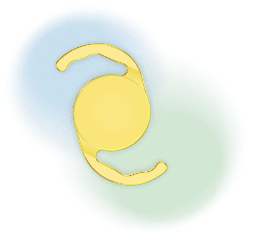 Monofocal intraocular lens - Ev gold - Aurolab