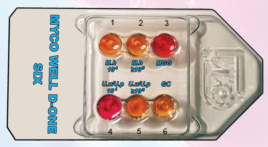 Bacterial vaginosis test kit - MS01379 - CPM SAS - for microbiology ...