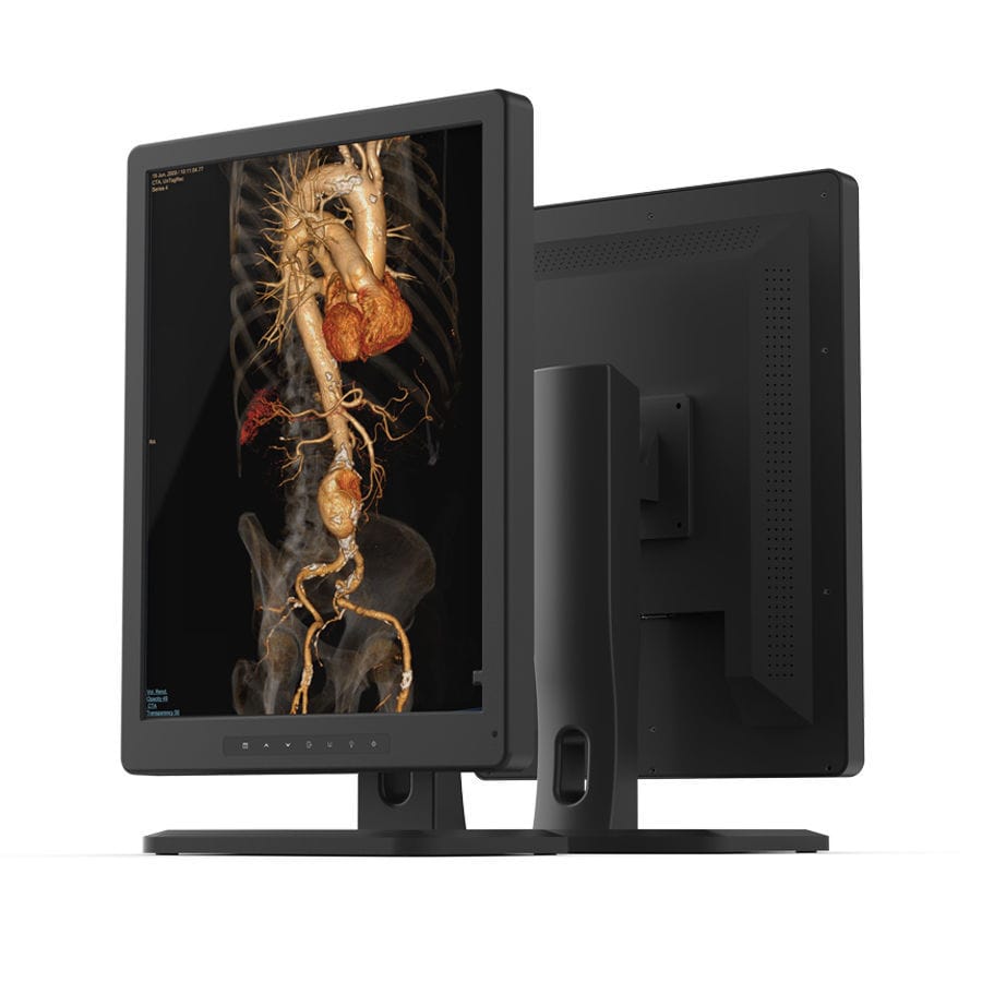 Diagnostic display - 21X2C-I0 - KTC Medical Solutions - radiology / 21 ...