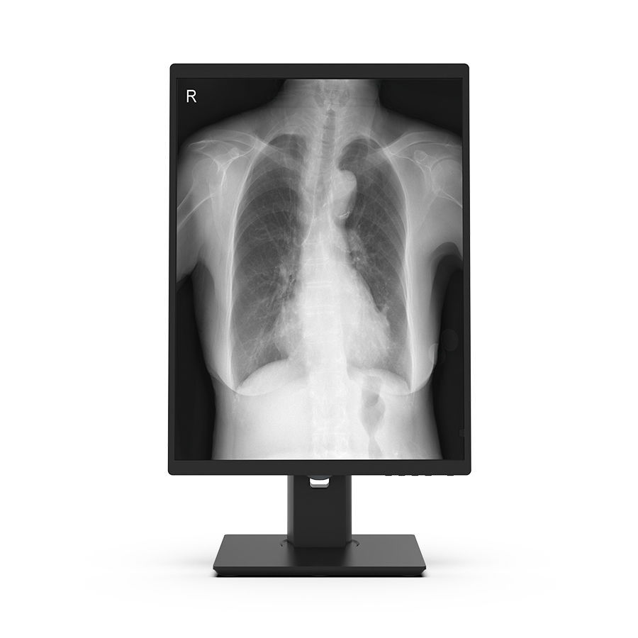 Diagnostic display - 21X3M-I3 - KTC Medical Solutions - radiology ...
