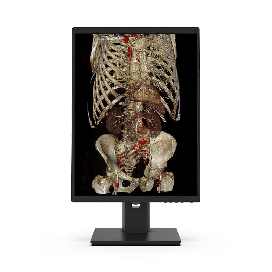 Diagnostic display - 21X3C-I3 - KTC Medical Solutions - radiology / 21 ...