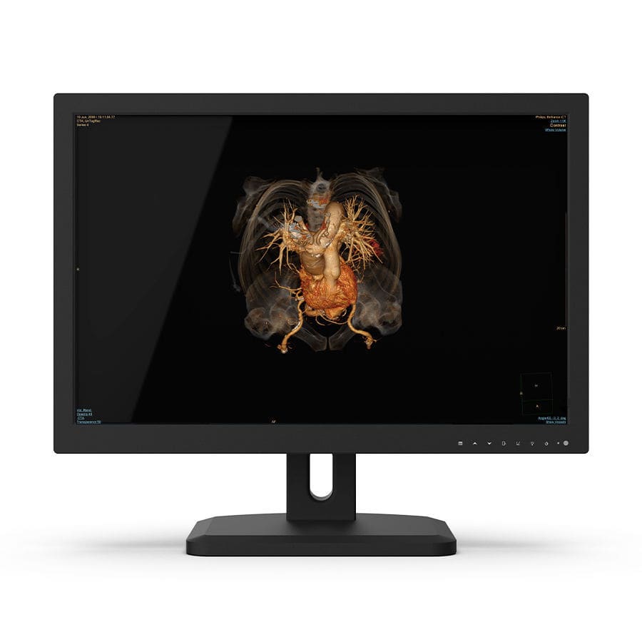 Diagnostic display - 24X20-B - KTC Medical Solutions - radiology / 1920 ...