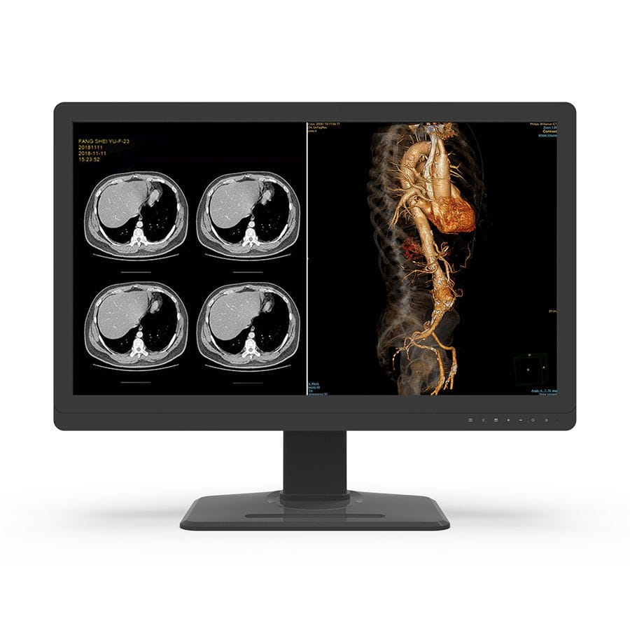 Diagnostic display - 32X8C-L0S - KTC Medical Solutions - radiology ...