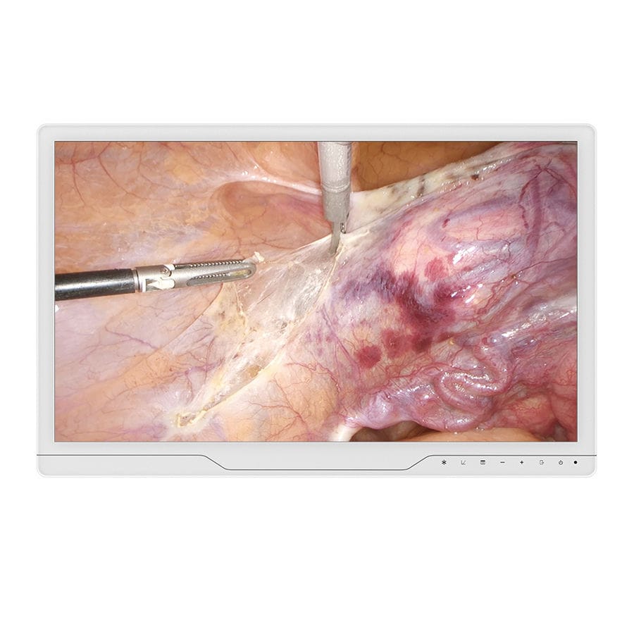 Endoscopy display - 22A30 - KTC Medical Solutions - 1920 x 1080 / 21.5 ...