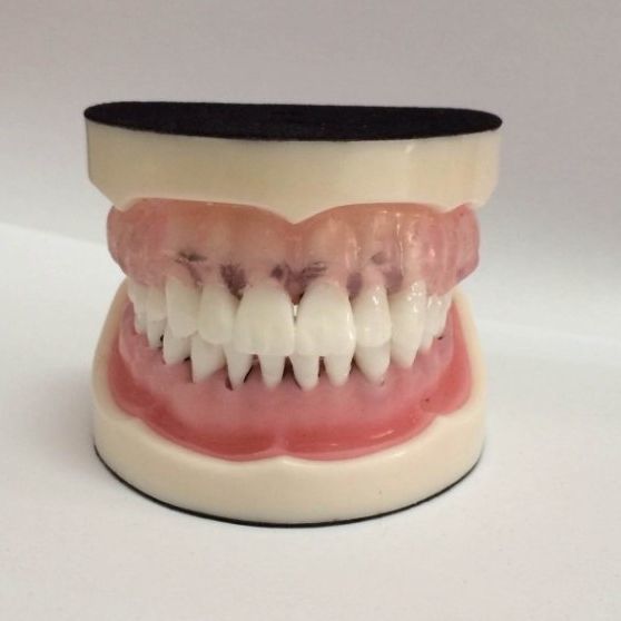 Mouth anatomical model - DOTFOX - for dental hygiene