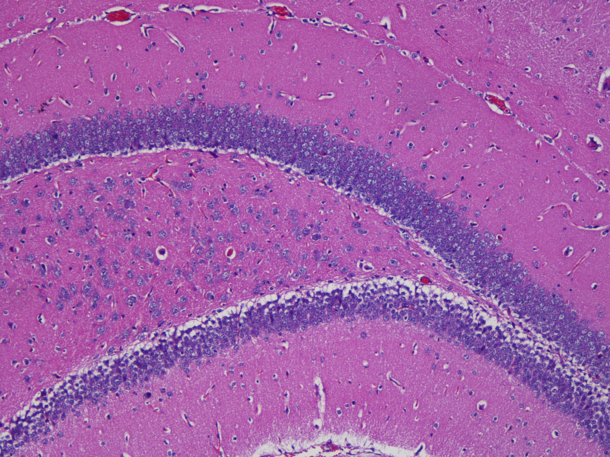 Harris hematoxylin reagent kit - KH07005 - Bioquochem - for research / for histology / acetic acid