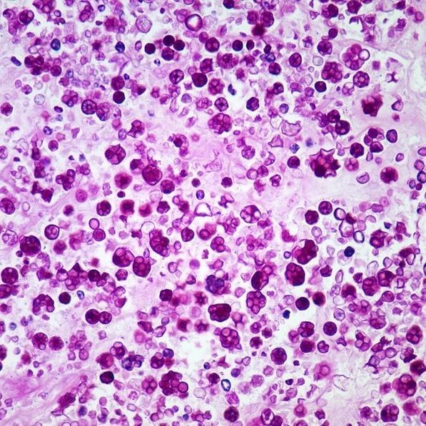 Mayer’s hematoxylin-Eosin reagent kit - KH07011 - Bioquochem - for ...