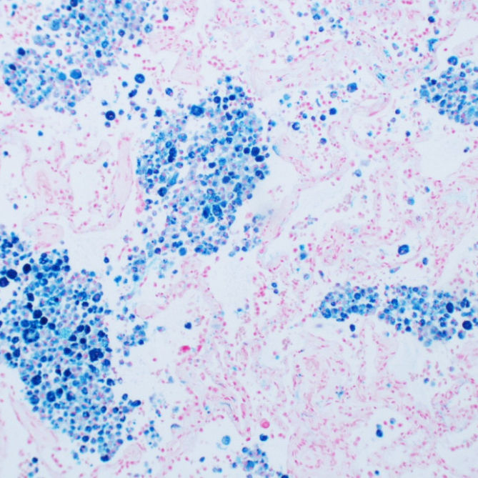 Iron reagent kit - KH07014 - Bioquochem - stain / for research / for ...