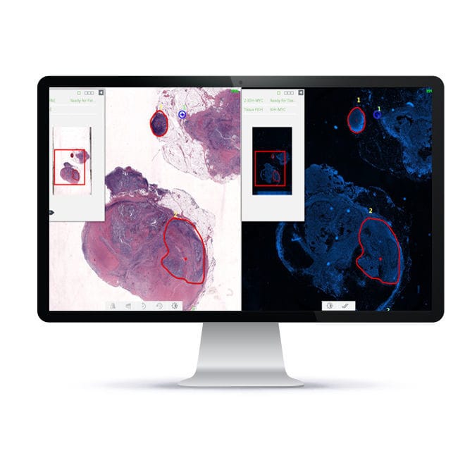Automatic cell imaging system - PathFusion™ - Applied Spectral Imaging ...
