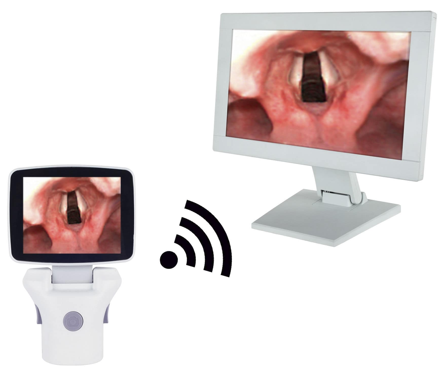 Endoscopy monitor - TL-15T1080-Ⅱ - Shenzhen Tianlang Medical Equipment ...