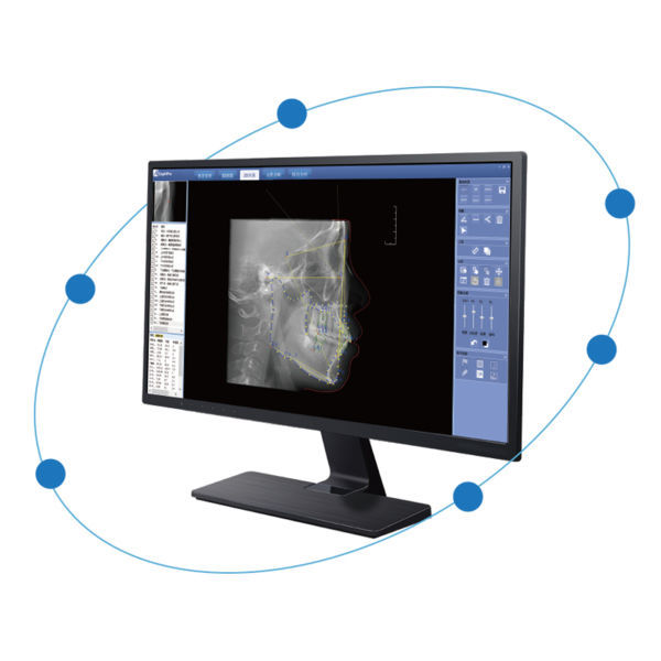 Analysis software - CephPro3D - LargeV Instrument - diagnostic / measurement / treatment