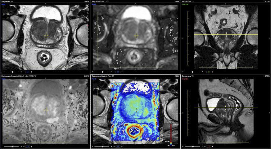 Analysis software - Advantis Medical Imaging - reporting / viewer / for MRI