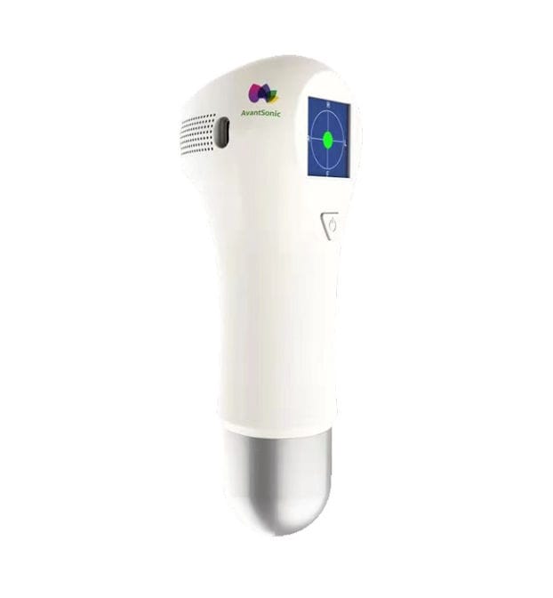 Hand-held bladder scanner - AS-2 - AvantSonic