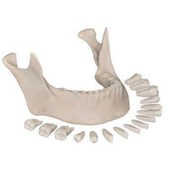 Bone model - EXT-1 - Selmodels SL - mandible / teeth / extraction
