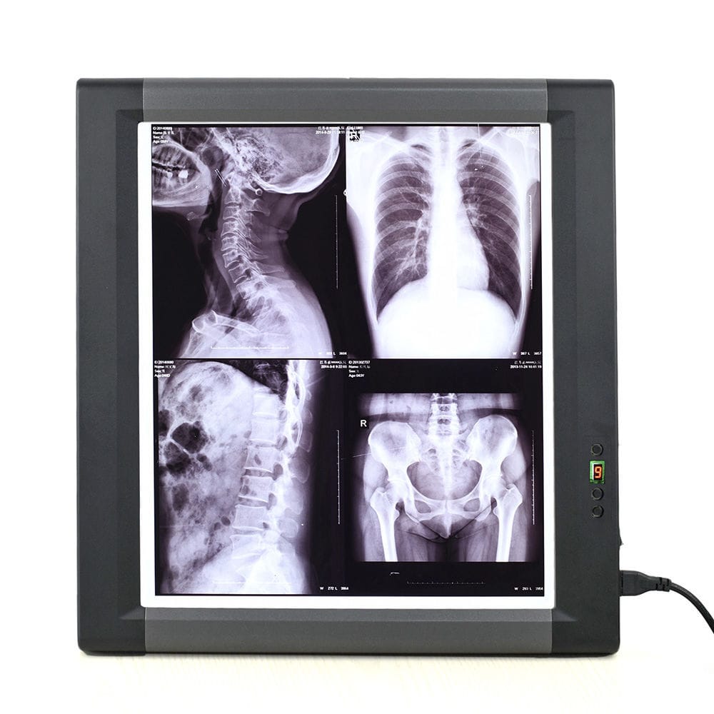 Digital X-ray film viewer - MG01 - Nanchang Micare Medical Equipment ...