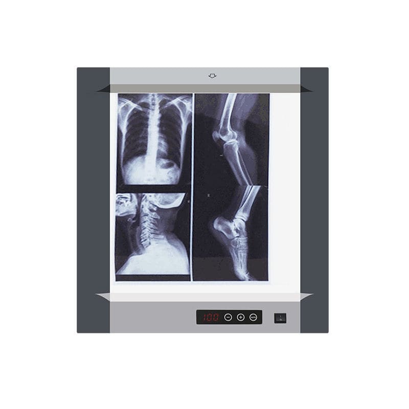 Digital X-ray film viewer - MG-01 - Nanchang Micare Medical Equipment - 1-screen / white light ...