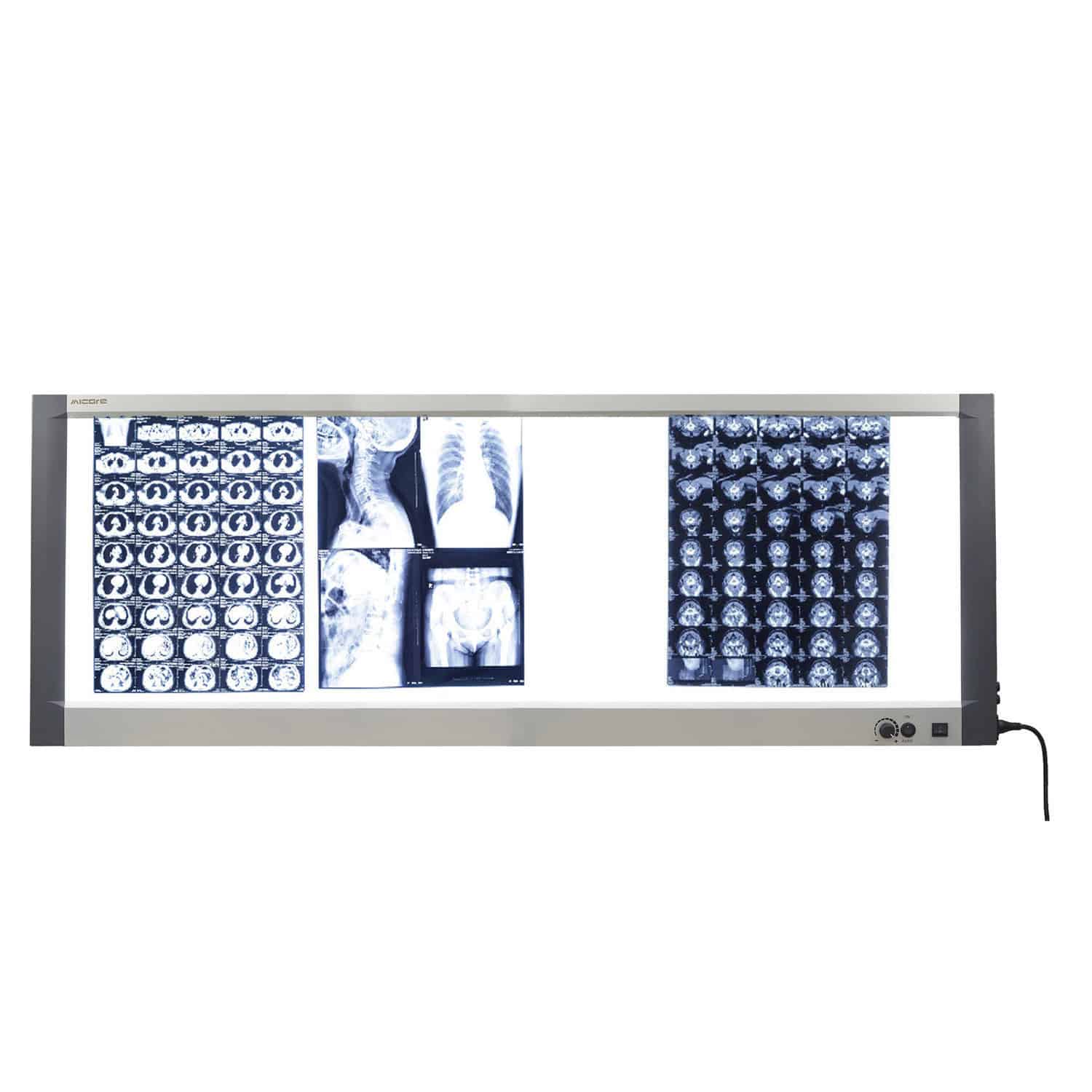 4-screen X-ray film viewer - MG-04X - Nanchang Micare Medical Equipment ...