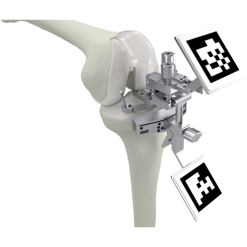 ACL ligament movement assessment system - PIXEE KNEE + - Gruppo ...