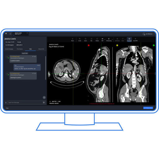 Traumatology software - Viz.ai - reporting / viewer / sharing