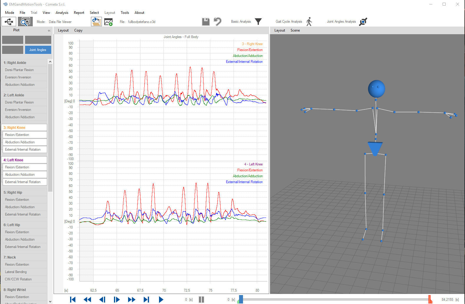 EMG software - Cometa - hospital / analysis