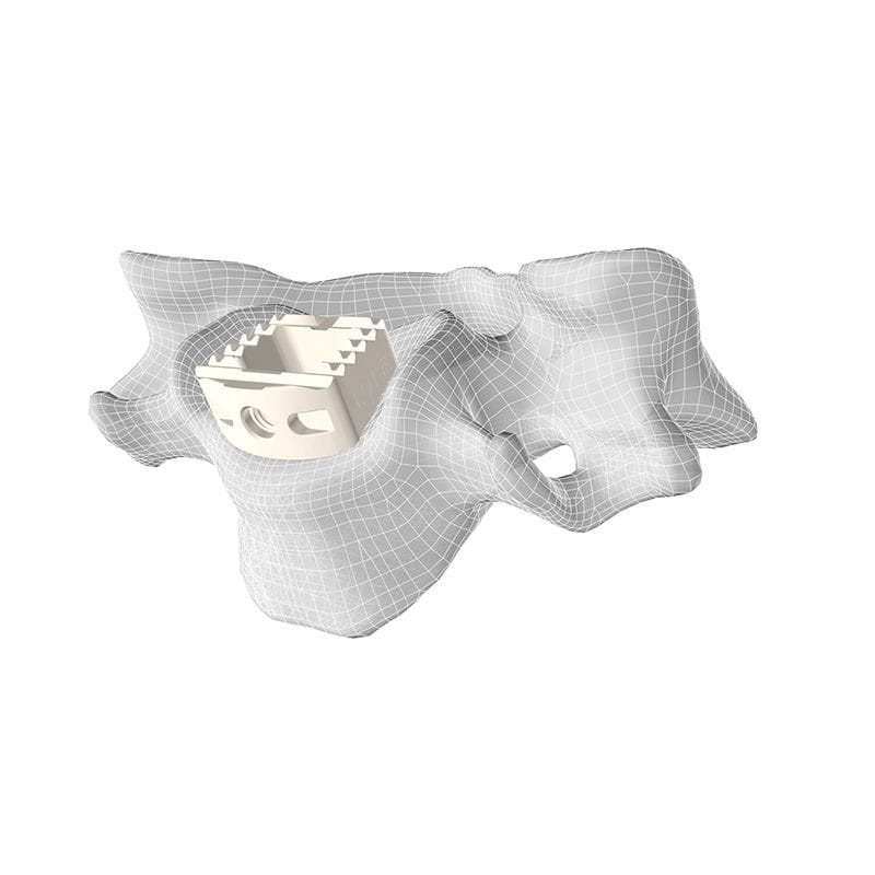 Cervical interbody fusion cage - CL5™ - Corelink Surgical - anterior / PEEK