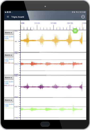 Visualization software module - EMG Plots - Delsys - treatment planning ...