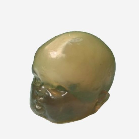 Ultrasound imaging test phantom - Simple Head - True Phantom Solutions ...