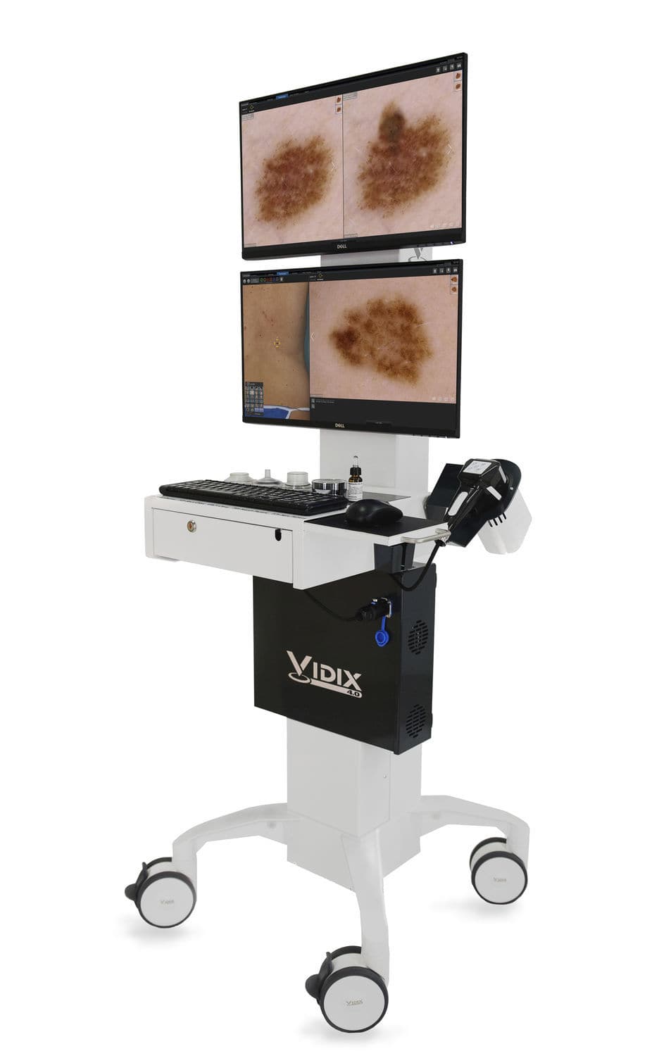 Video dermatoscope - VIDIX 4.0 - Medici Medical - white LED / computer ...