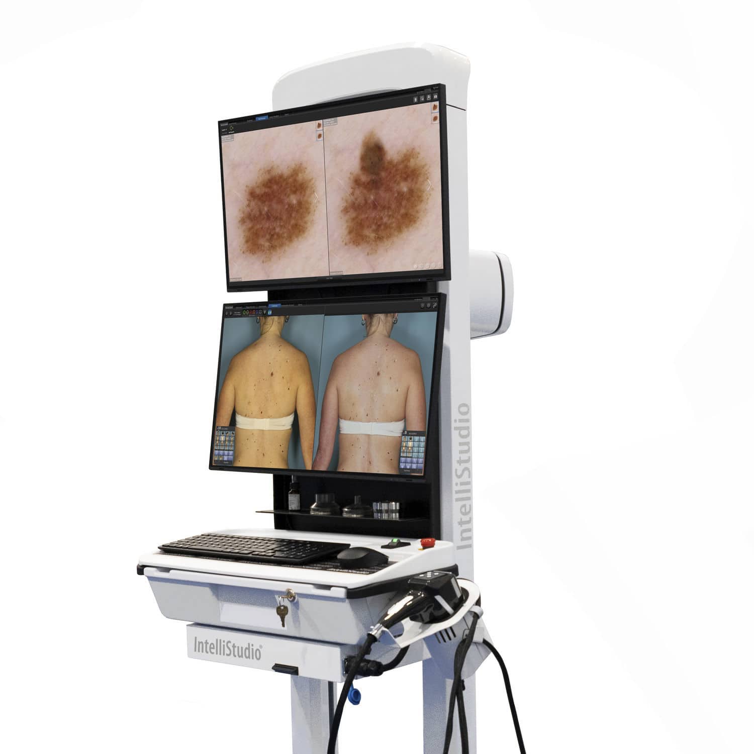 Video dermatoscope - IntelliStudio3 - CANFIELD - white LED / computer ...