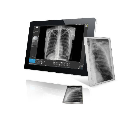 Imaging system - AVANSE DR - Visaris