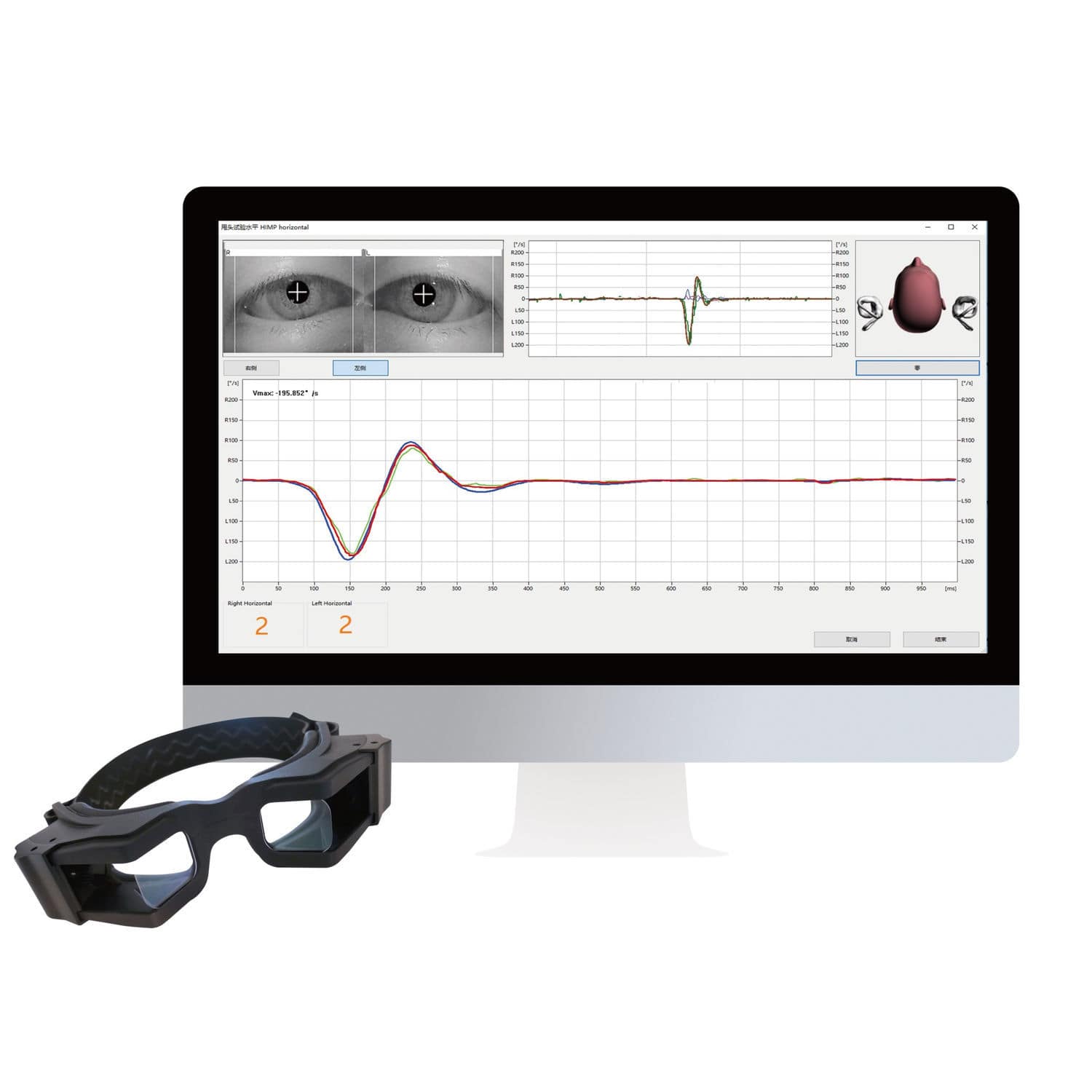 Videonystagmography system - VertiGoggles - Shanghai ZEHNIT Medical ...