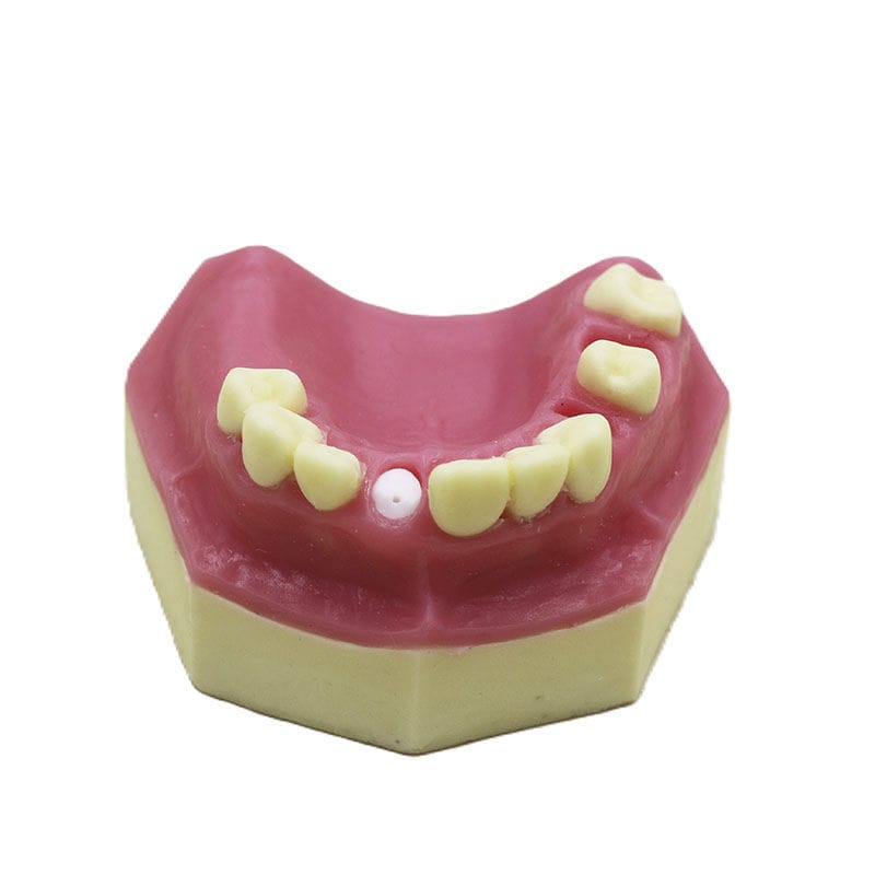 Tooth model - G-Y27 - FOSHAN JINGLE MEDICAL EQUIPMENT CO., LTD - dental ...