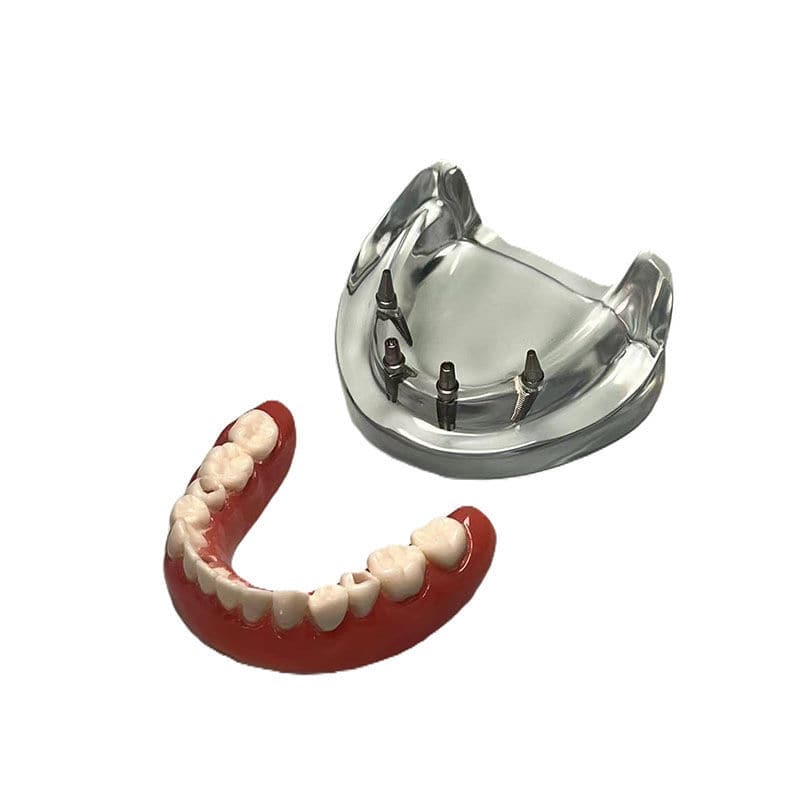 Denture model - JG-Y20 - FOSHAN JINGLE MEDICAL EQUIPMENT CO., LTD - jaw ...