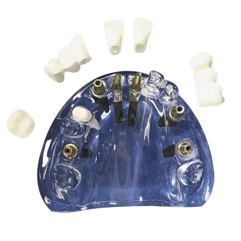 Dental model - JG-Y16 - FOSHAN JINGLE MEDICAL EQUIPMENT CO., LTD - for ...