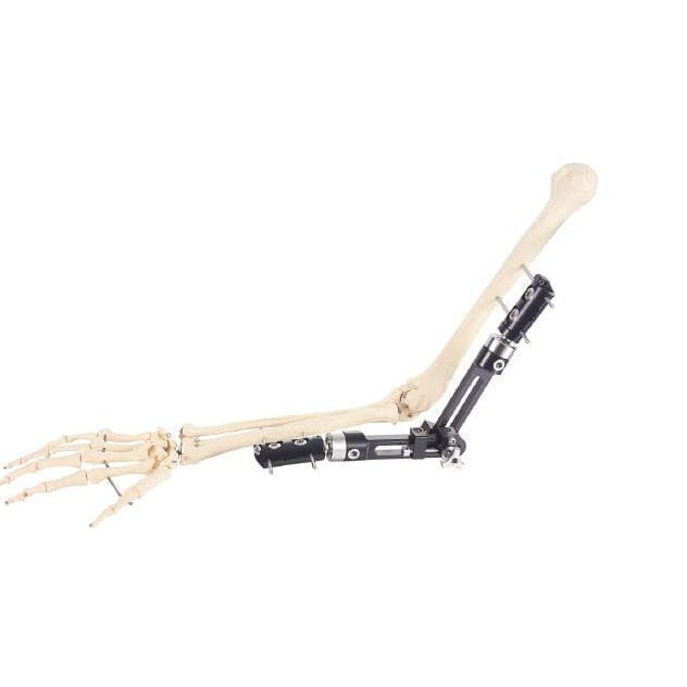 Elbow external fixation system - Wuhan Yijiabao Biological Materials ...