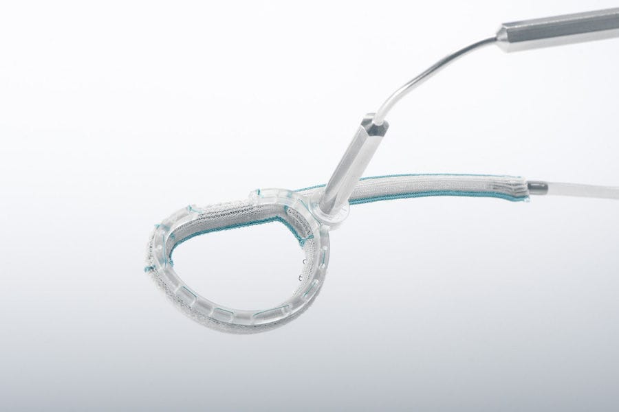 Mitral valve cardiac restoration system - KALIOS - Affluent Medical