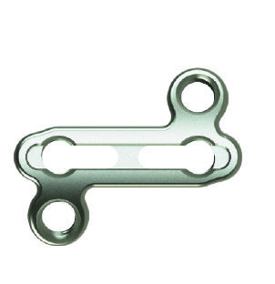 Talonavicular joint arthrodesis arthrodesis plate - DynaFORCE® T/N ...