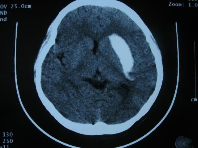 Multipurpose radiography X-ray film - KND-A/KND-F - Shenzhen Kenid ...