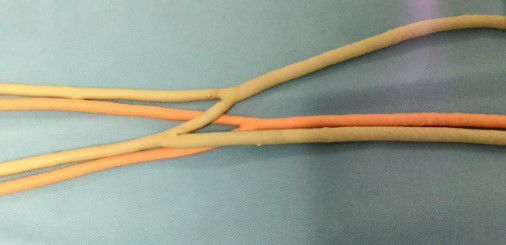 Artery model - SimuVasc - vein / vascular access / fistula