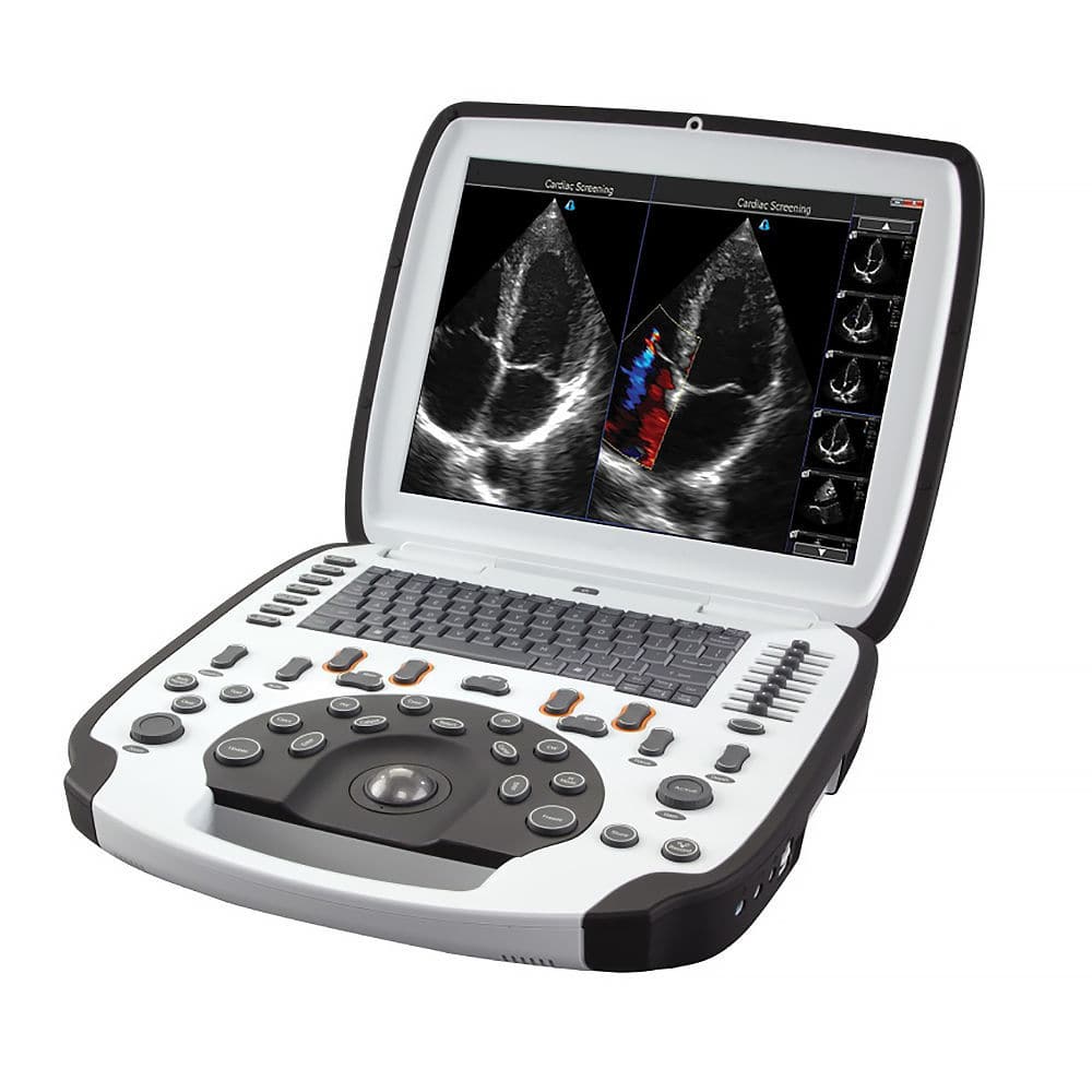 Portable ultrasound system - uSmart3300 NexGen - DELBio - for ...